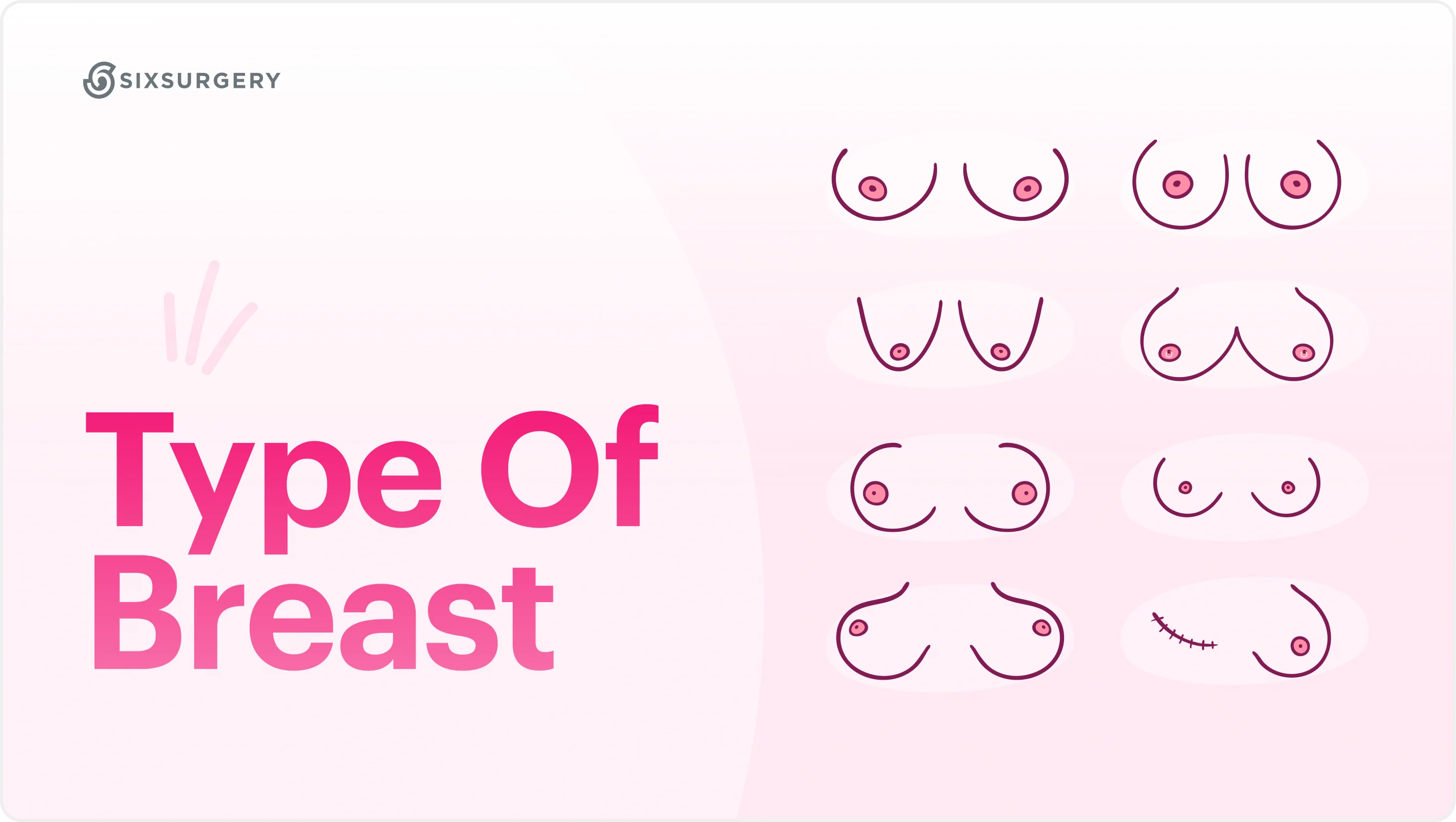 Types Of Breast Shapes
